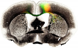 Whole Brain wiring Diagram – We have reached an important milestone ...